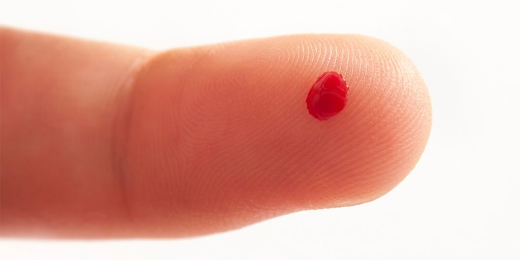 Zašto se krv uvek vadi iz četvrtog prsta? - Ordinacija.tv