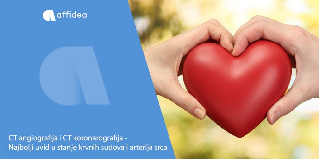 CT angiografija i CT koronarografija - Najbolji uvid u stanje krvnih ...