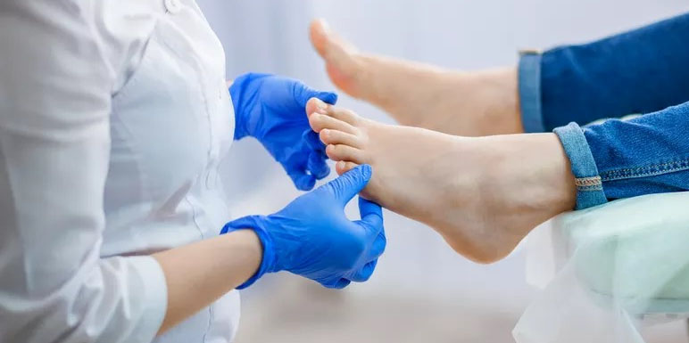 Atletsko stopalo (gljivična infekcija stopala) - Dijagnoza i lečenje ...